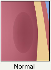 normal-macular-degeneration | Banville Optical